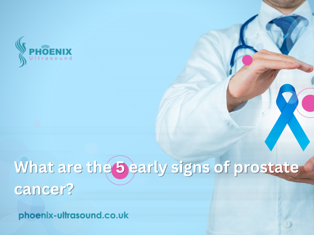 What are the 5 early signs of prostate cancer?